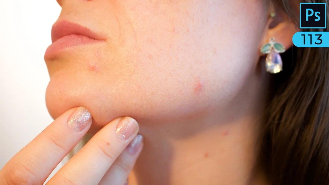 How to remove acne in Adobe Photoshop