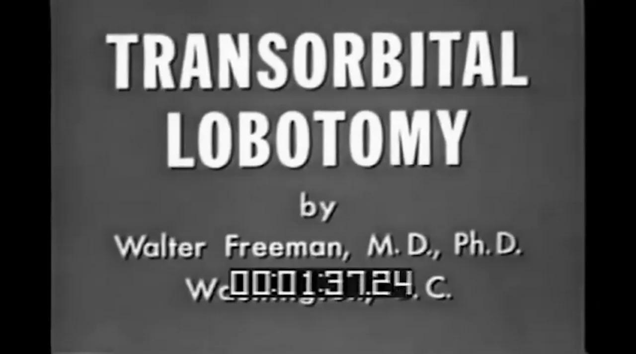 Trust the Science — Ice Pick Lobotomy by Walter Freeman (colorized)