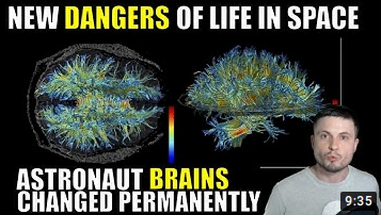 Dangers of Life in Space - Evidence of PERMANENT Brain Changes ...