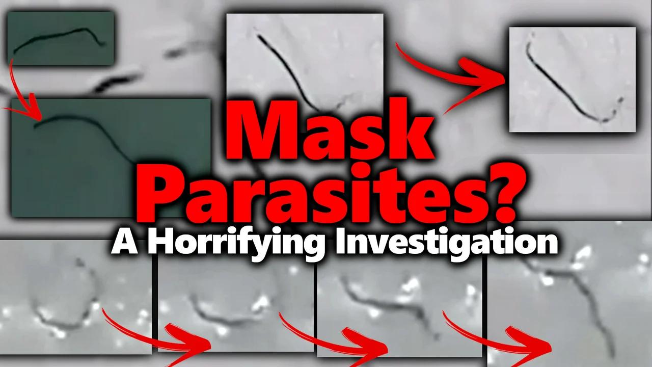 Are These Parasites? Moving Black Strands On Masks Compilation. Are ...