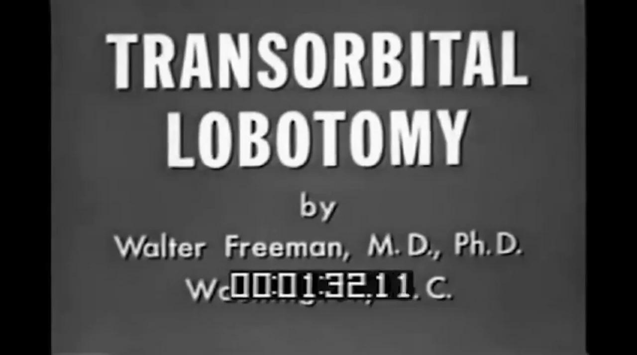 Trust the Science — Ice Pick Lobotomy by Walter Freeman