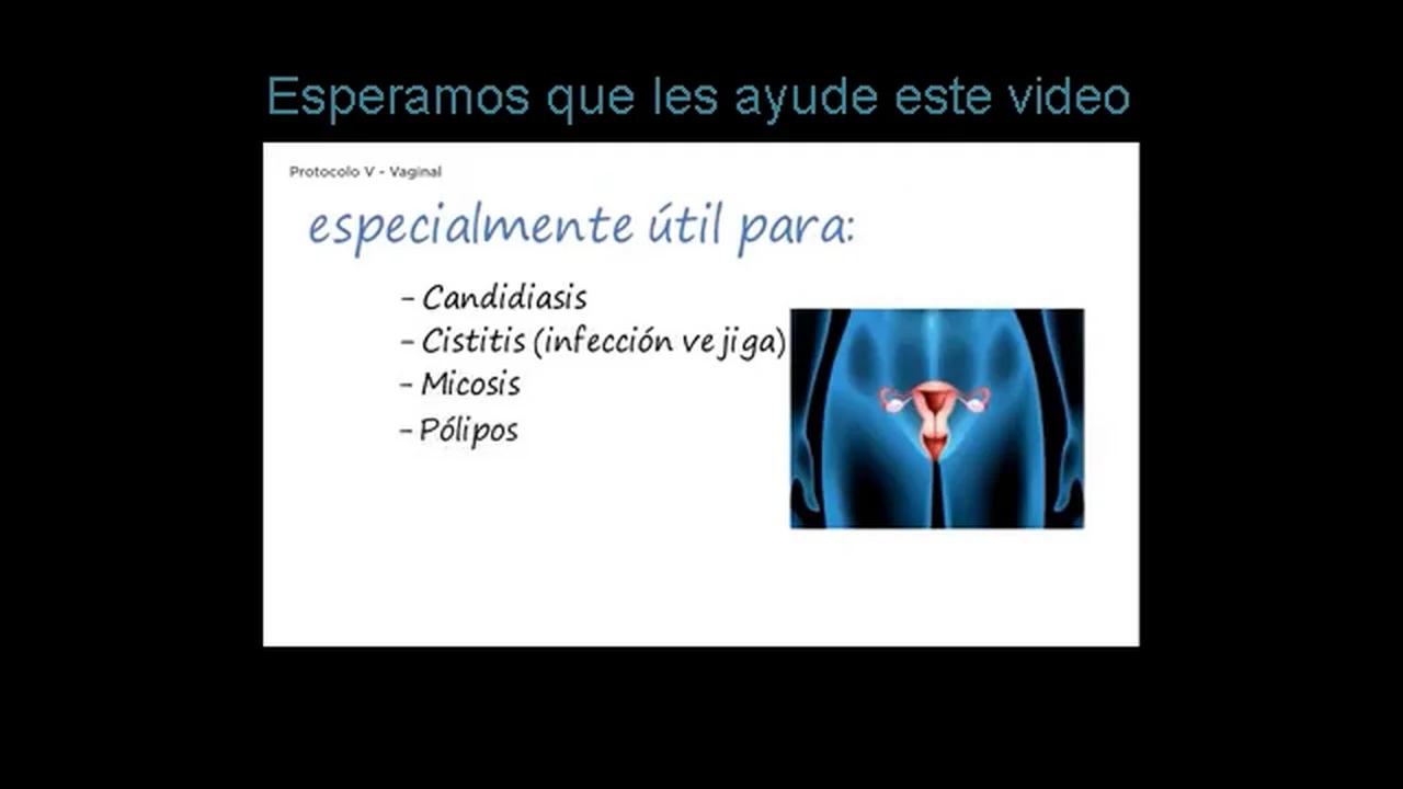 CDS protocolo V (Vaginal)