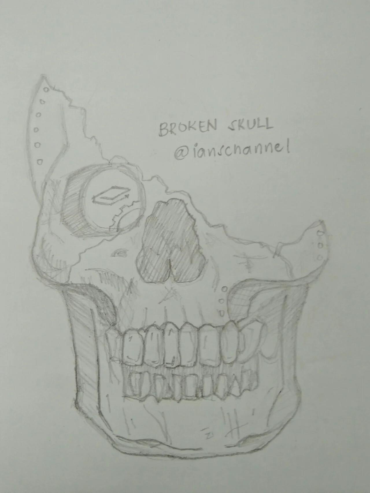 Broken Skull Drawing