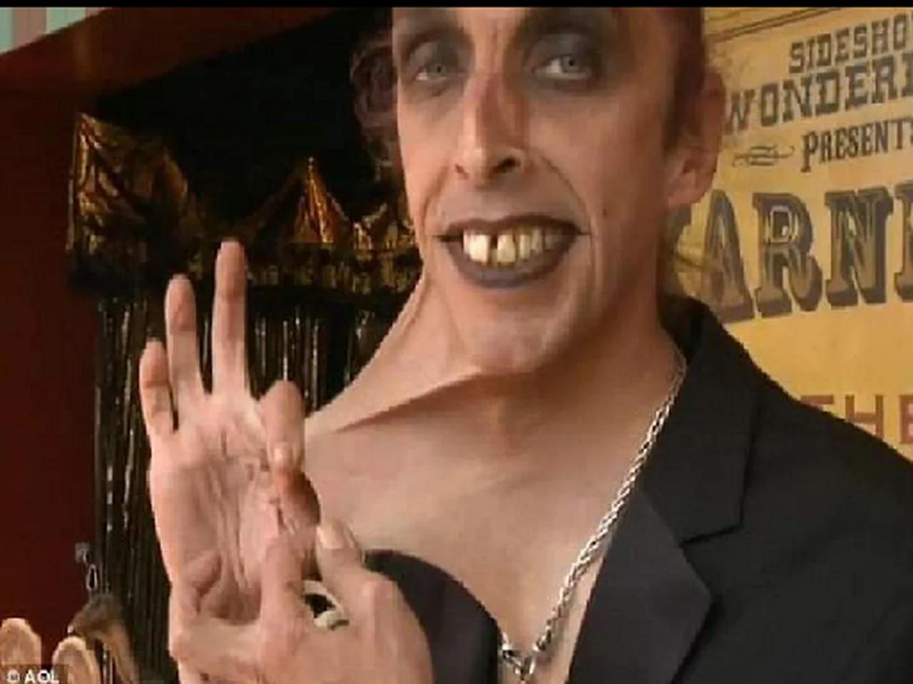 Stretchiest skin in the world! - Guinness World Records