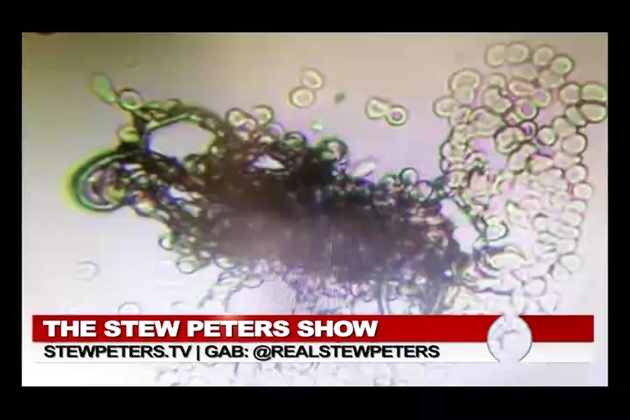 Exámenes exhaustivos de la Dra. Zandre Botha REVELAN la terrible ...