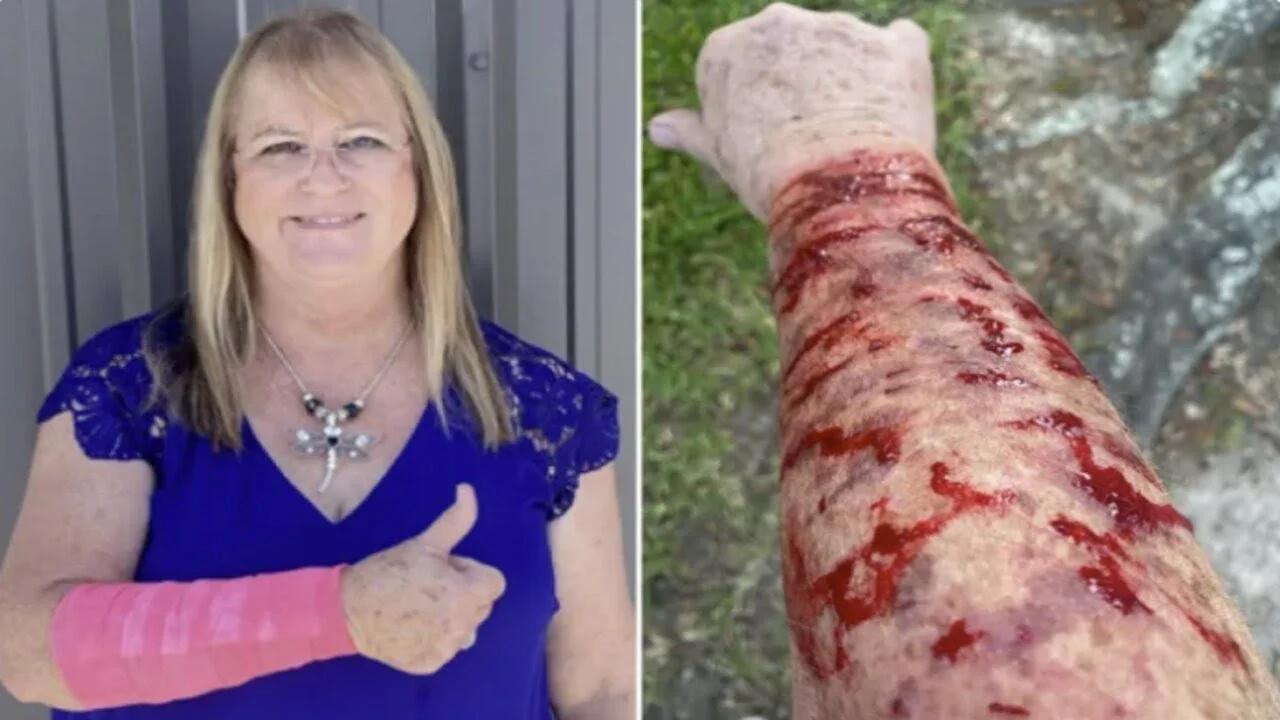 Hawk drops 4-foot-long snake on Texas woman, prompting both animals to ...