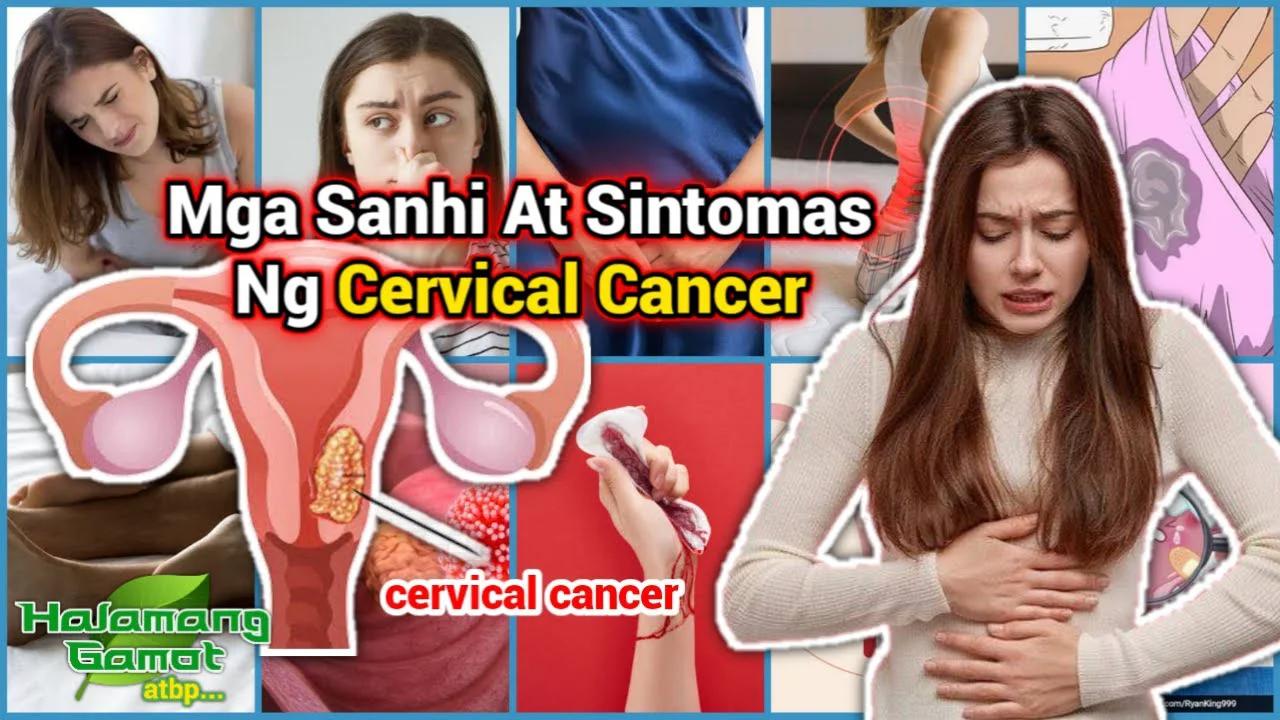 Mga Sanhi At Sintomas Ng Cervical Cancer | Halamang Gamot ATBP