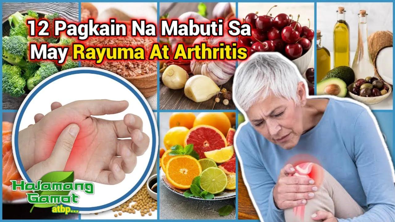 12 Pagkain Na Mabuti Sa May Rayuma At Arthritis | Halamang Gamot ATBP