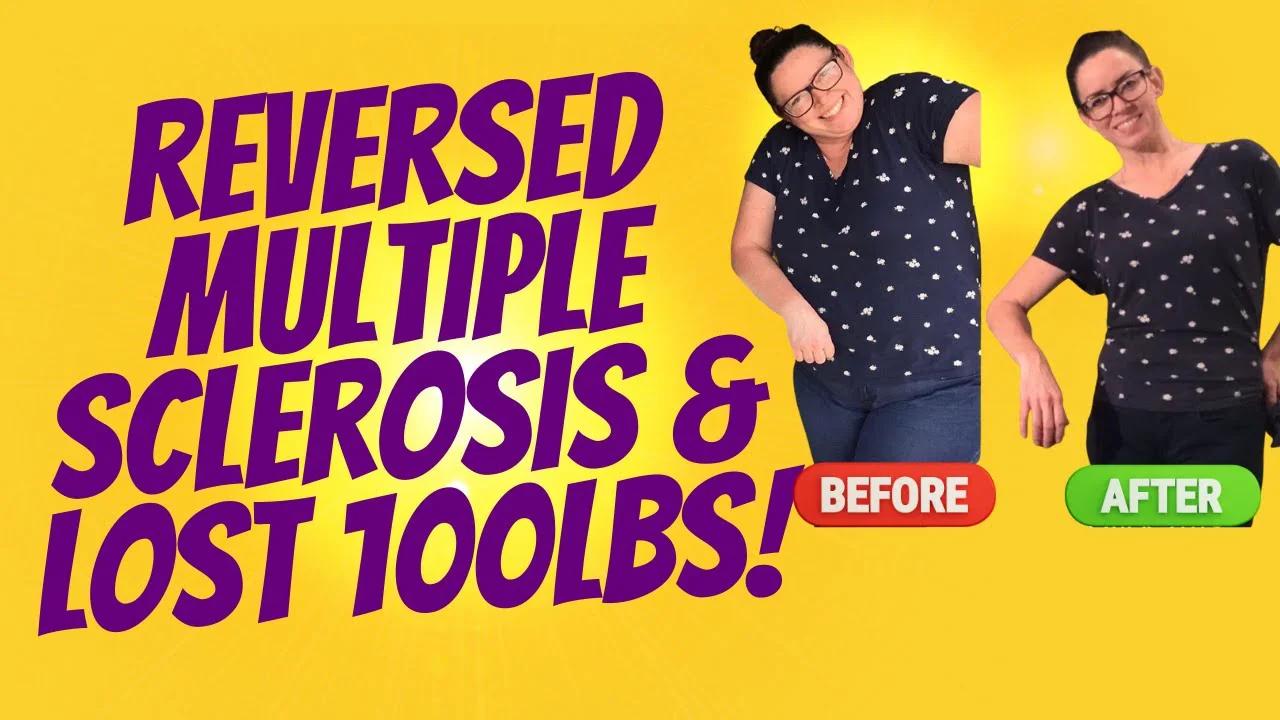 How Emily Penton Reversed Multiple Sclerosis and Lost Over 100lbs