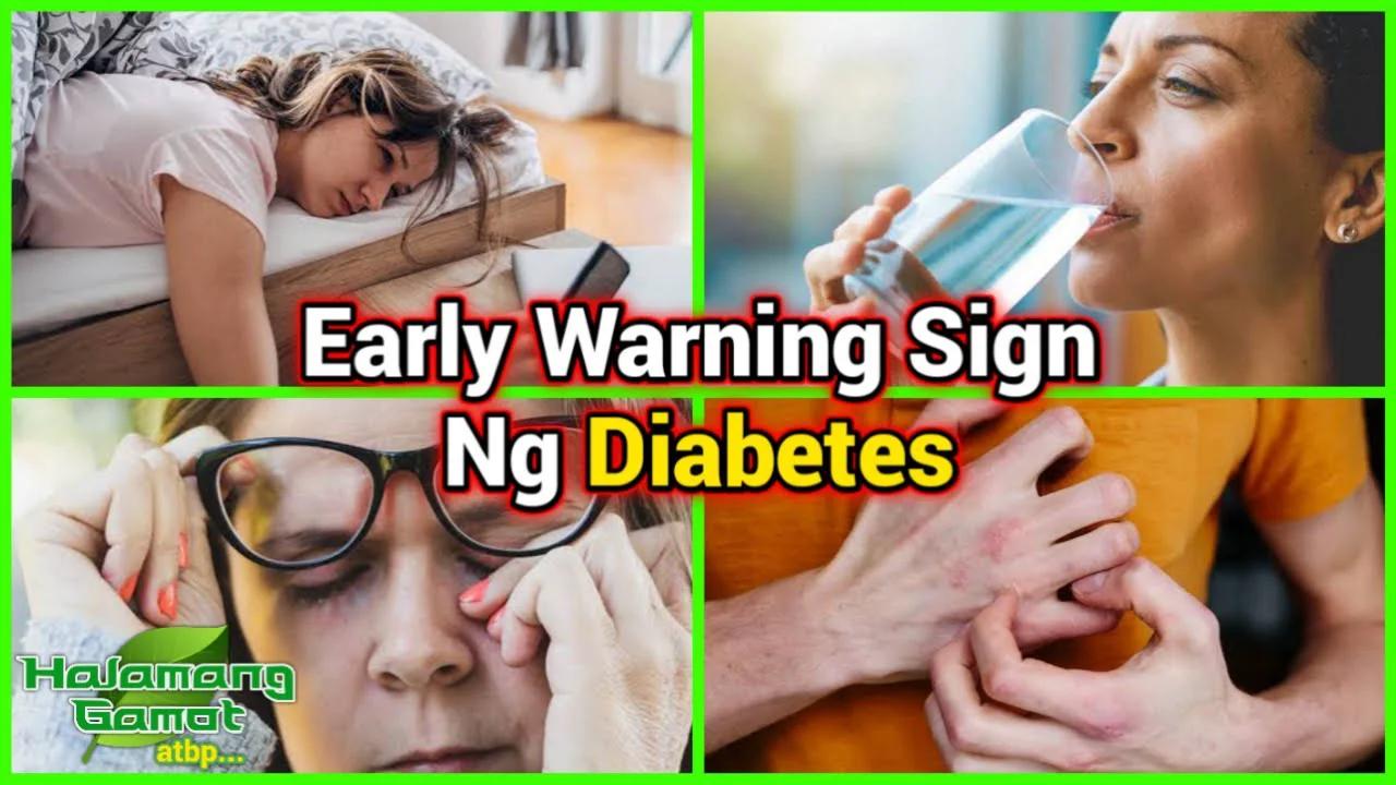 Early Warning Sign Ng Diabetes | Halamang Gamot ATBP