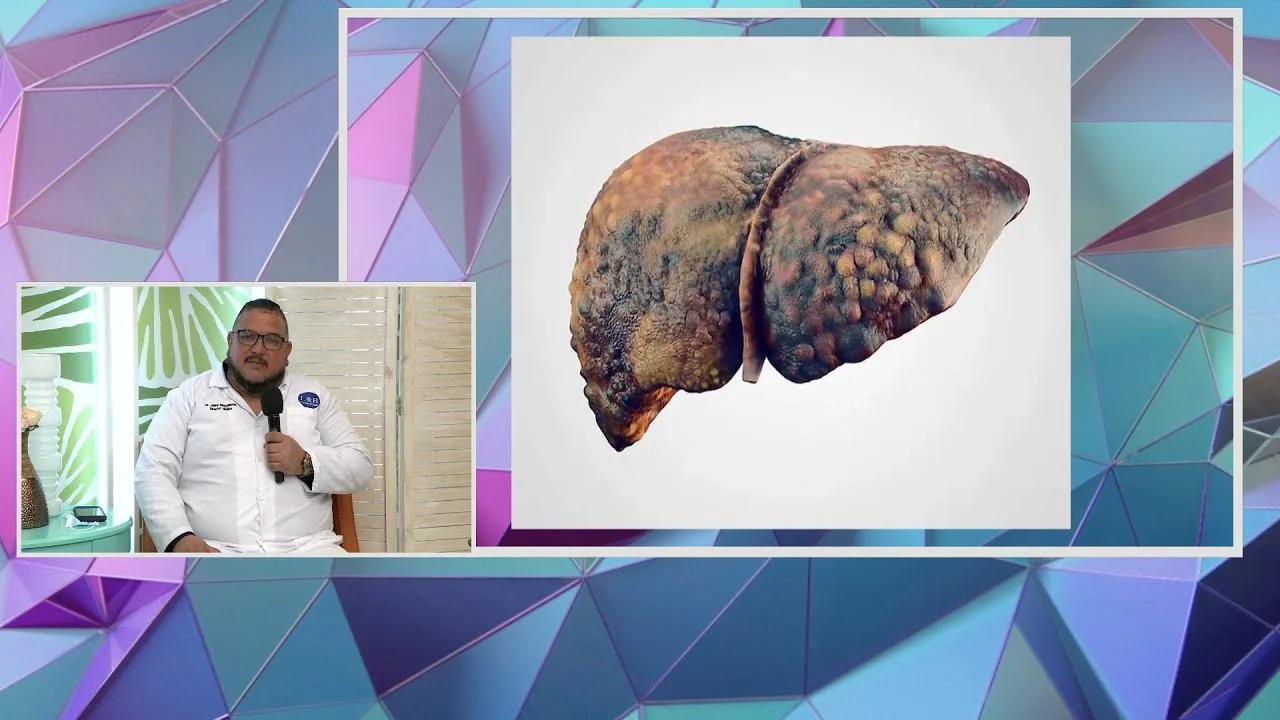 ¿Qué cuidados necesita una persona con cirrosis?