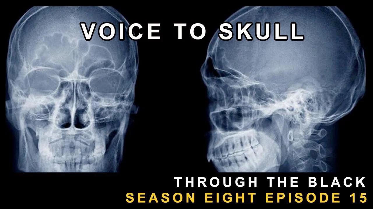 Voice to Skull