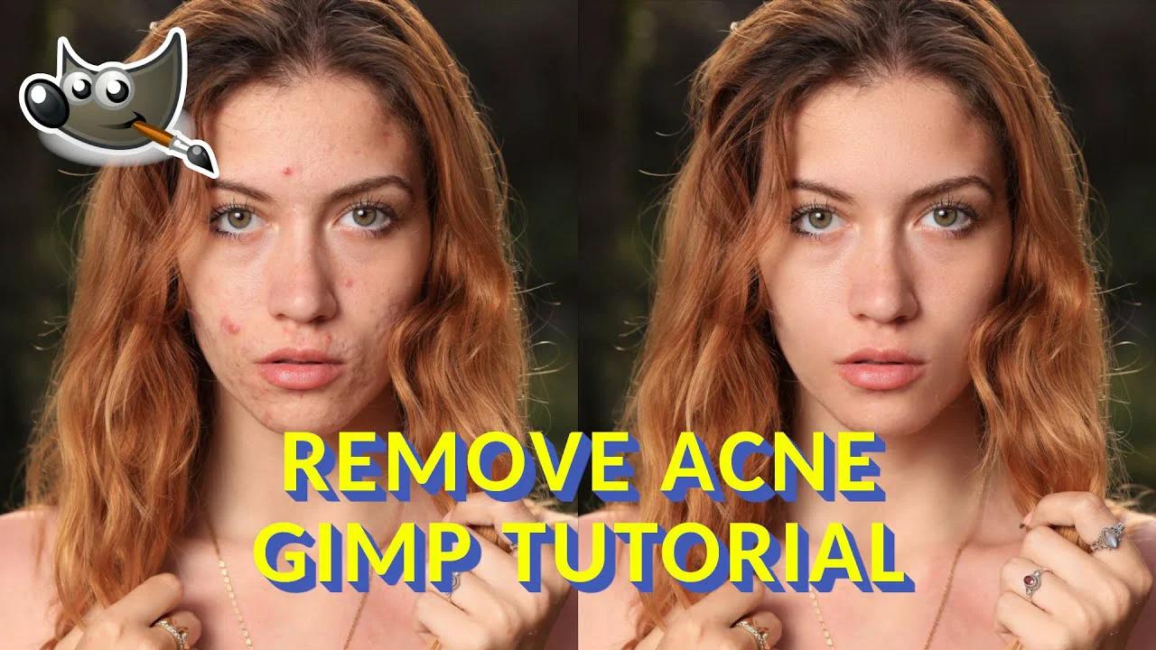 Acne Retouch Gimp Tutorial
