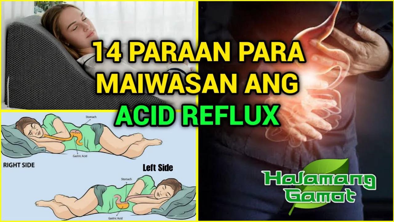Paraan para maiwasan ang Acid Reflux, Hyperacidity, Acidic, Heartburn ...