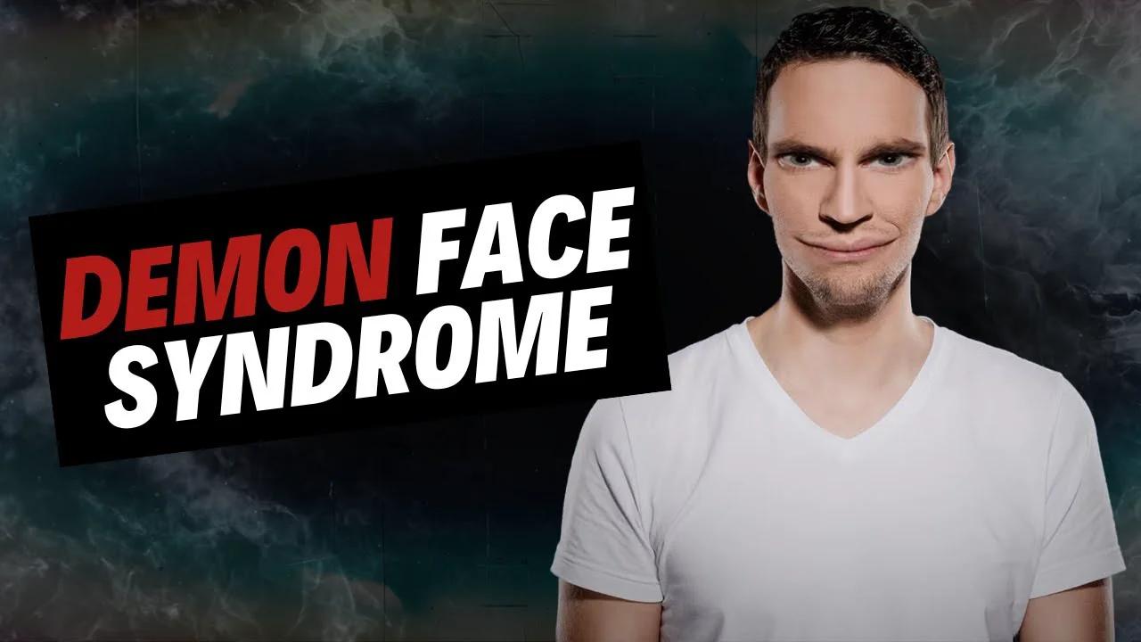 Demon Face Syndrome