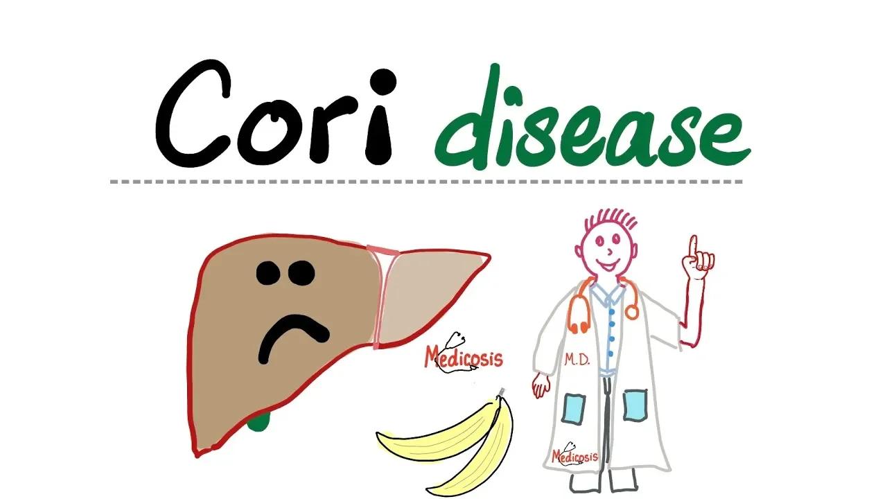 Cori disease (with a Mnemonic) - Glycogen Storage Disease (Type III ...