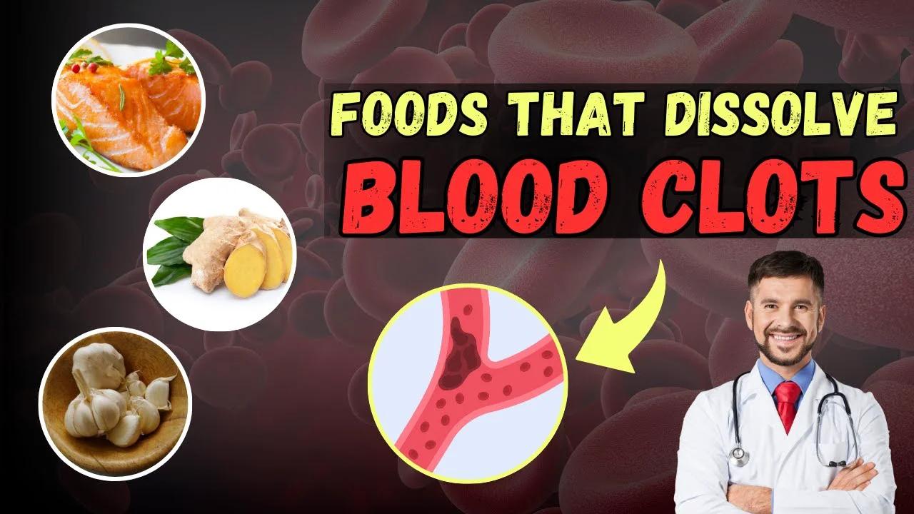 FOODS THAT DISSOLVE BLOOD CLOTS