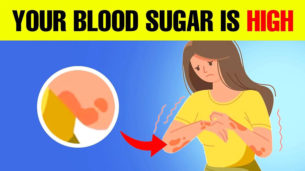 16 Signs Your Blood Sugar Is High and 8 Diabetes Symptoms