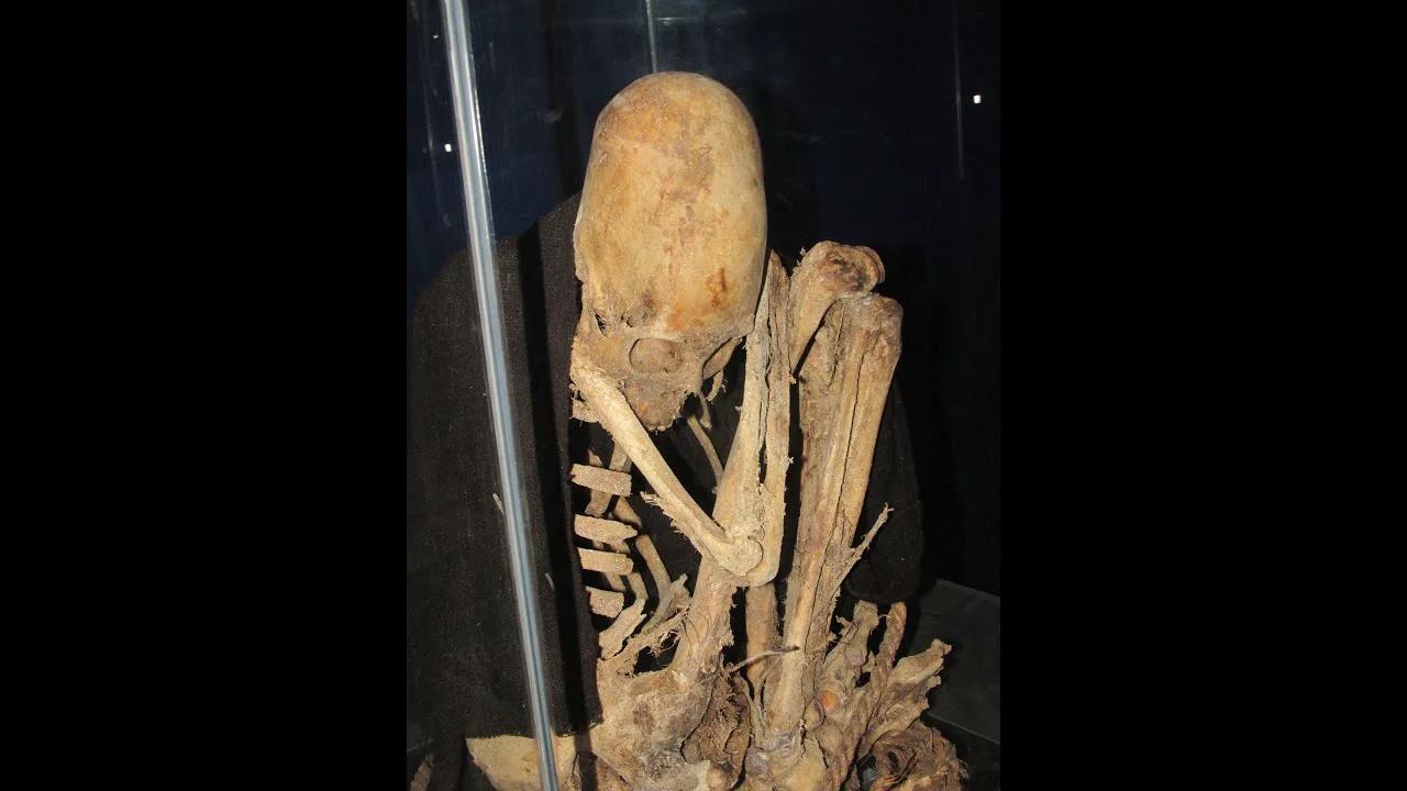 Two American Doctors Inspect Strange Skeletons With Elongated Skulls In ...