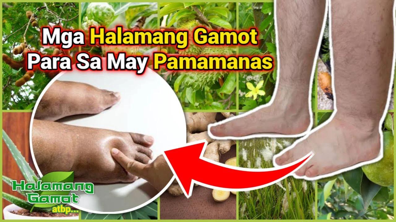 Mga Halamang Gamot Para Sa May Pamamanas Sa Paa At Kamay | Halamang ...
