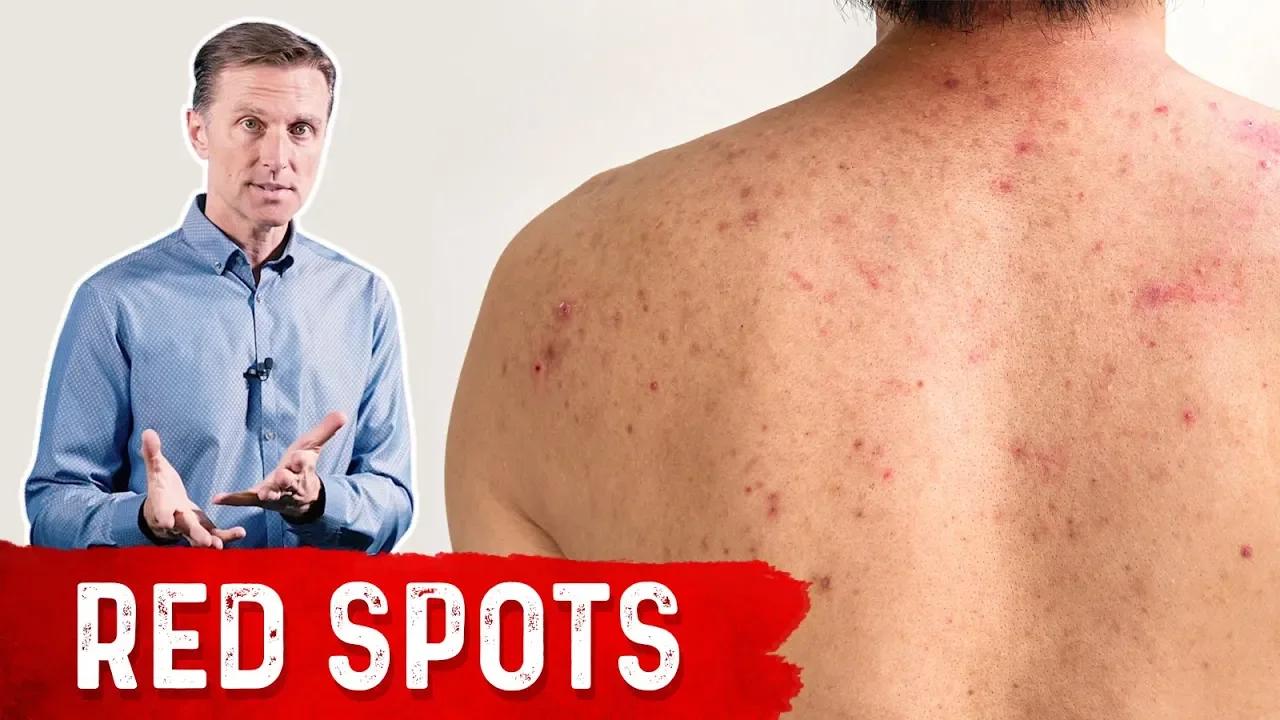 Why Red Spots on My Skin