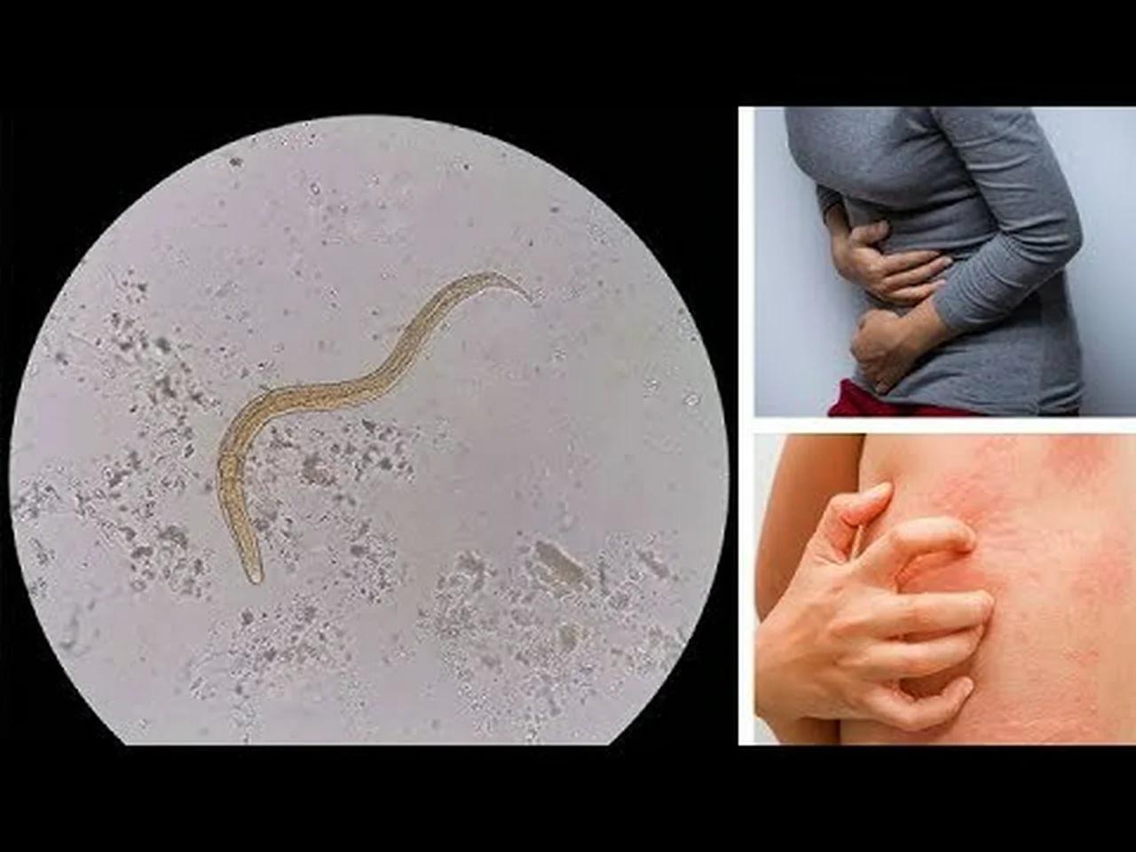 YOU HAVE PARASITES!!! | Juice Fast | Water Fast | Parasite Cleanse ...