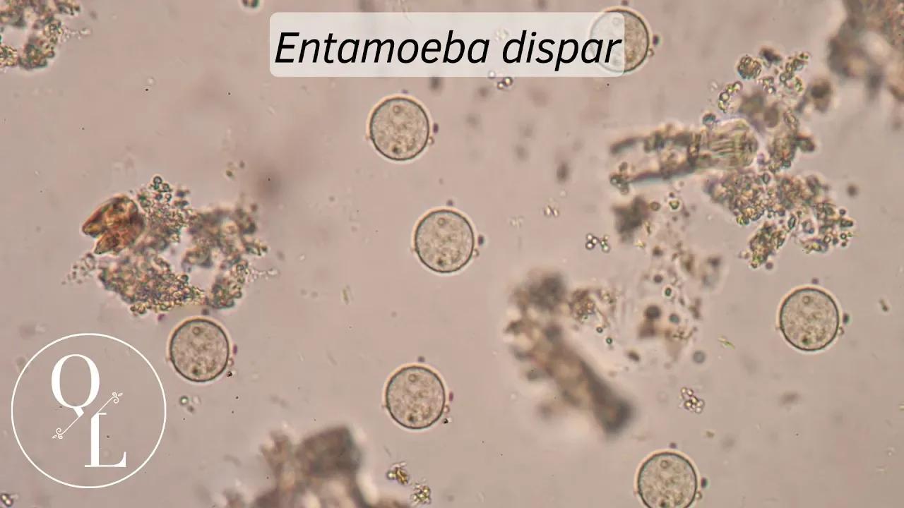 8. Entamoeba dispar