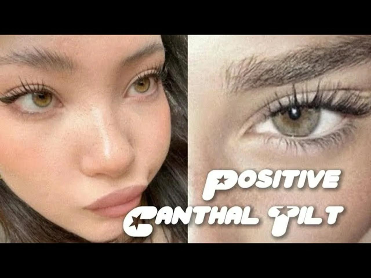 Positive Canthal Tilt