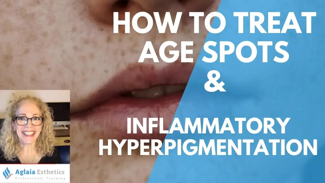 TREATMENTS FOR INFLAMMATORY HYPER-PIGMENTATION | AGE SPOTS