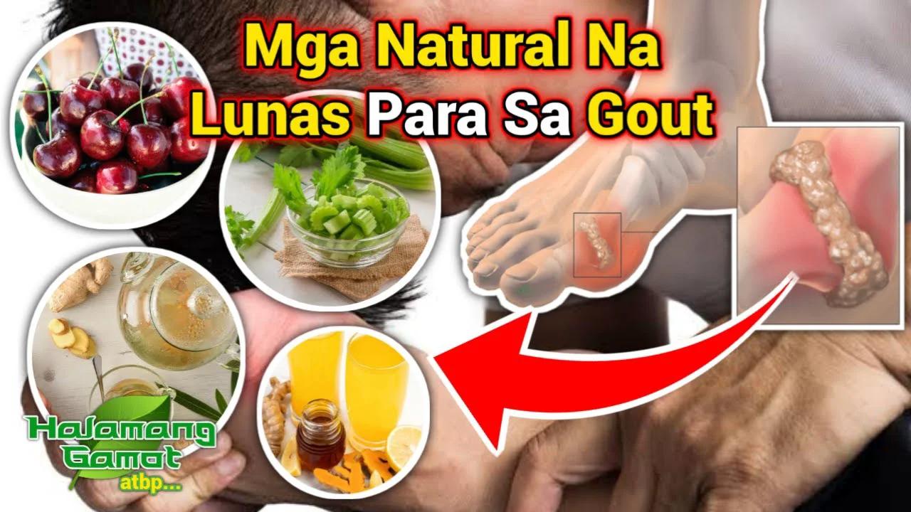 Mga Natural Na Lunas Para Sa Masakit At Namamaga Na Gout | Halamang ...