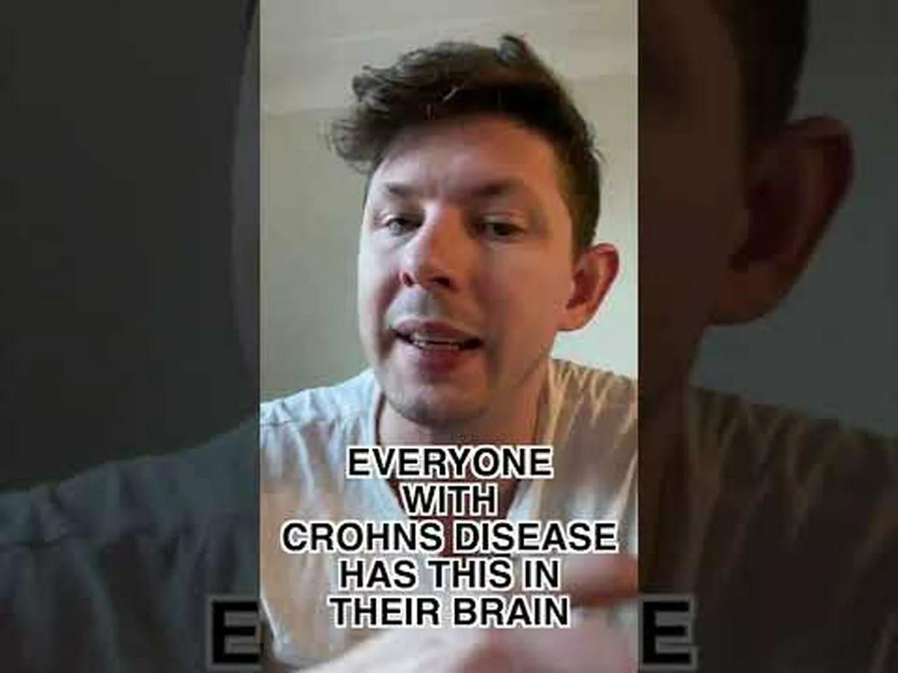 Crohn's Suffers Always Have A Scary Ring In Their Brain Scans... Right ...