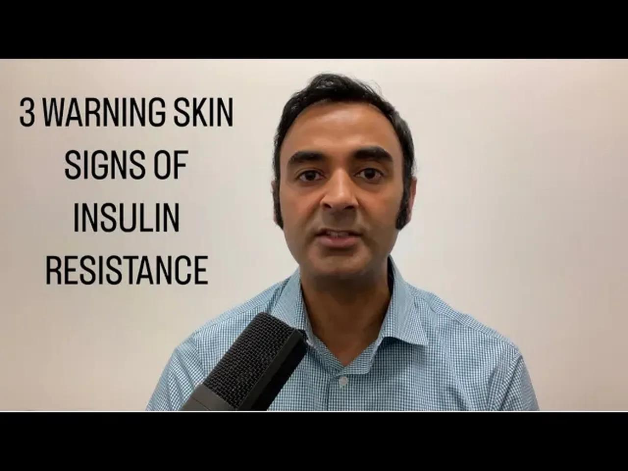 3 WARNING skin signs of INSULIN RESISTANCE (precursor to DIABETES)