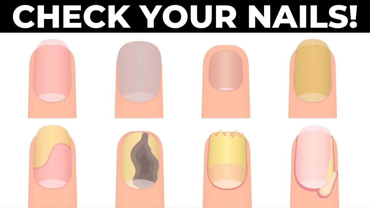 9 Things Your Nails Can Tell You About Your Health