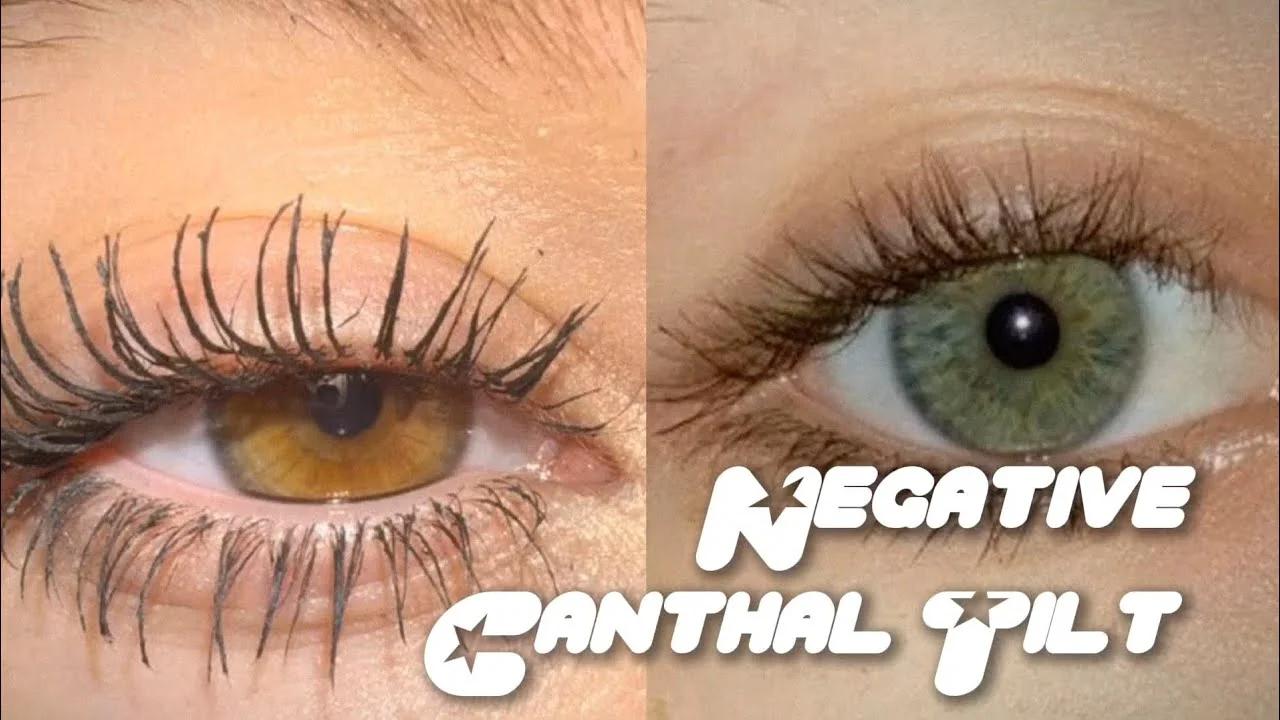 Negative Canthal Tilt
