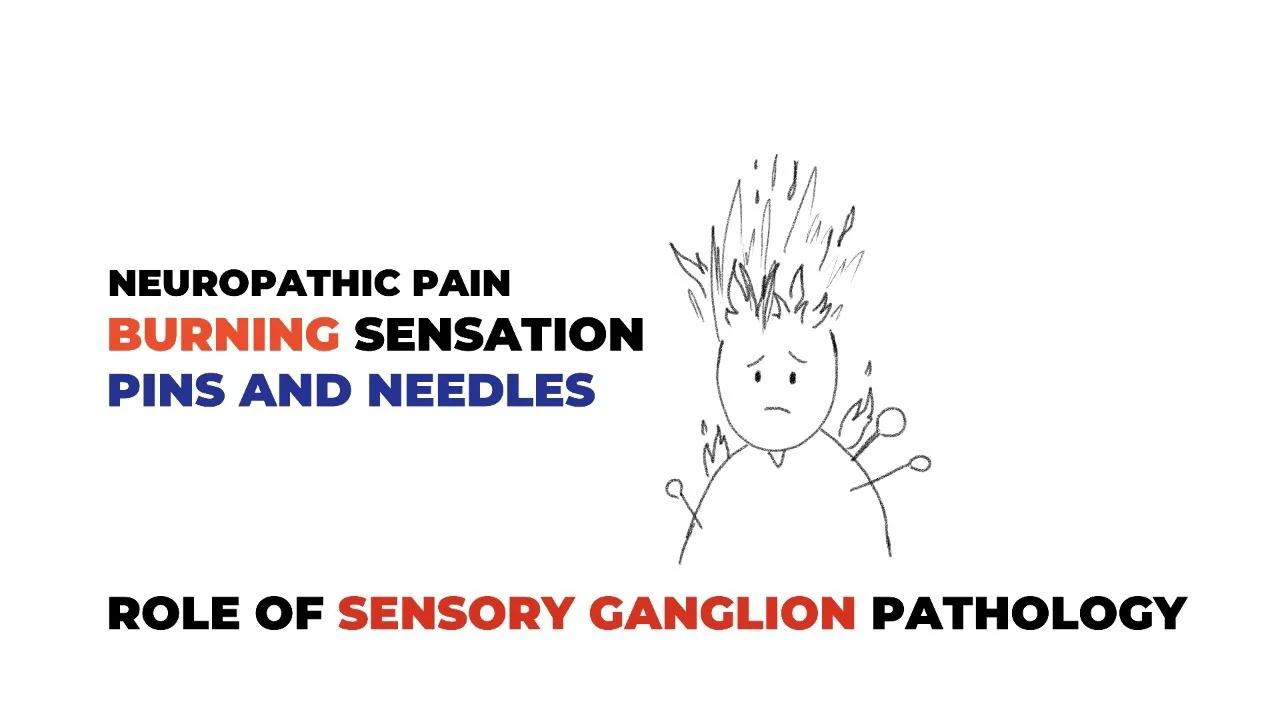 Burning Sensations, Pins and Needles. Neuropathic Pain.