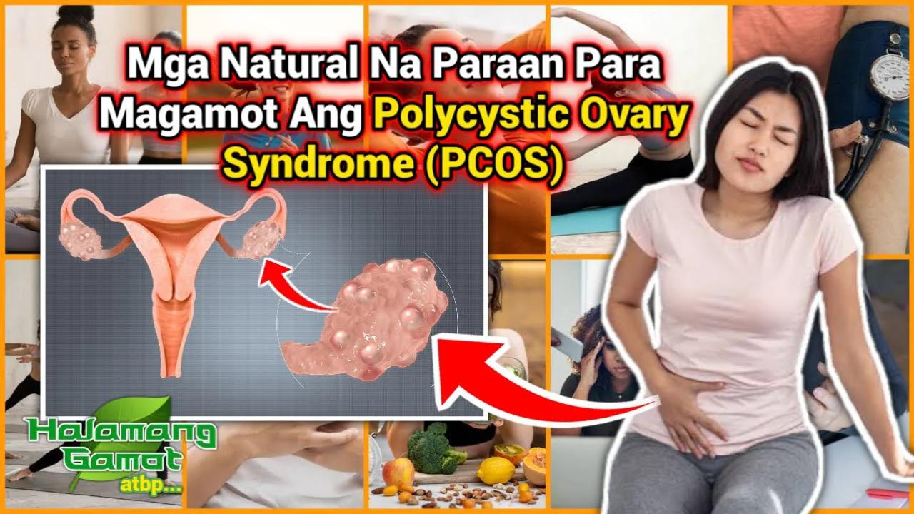 Mga Natural Na Paraan Para Magamot Ang Polycystic Ovary Syndrome o PCOS ...
