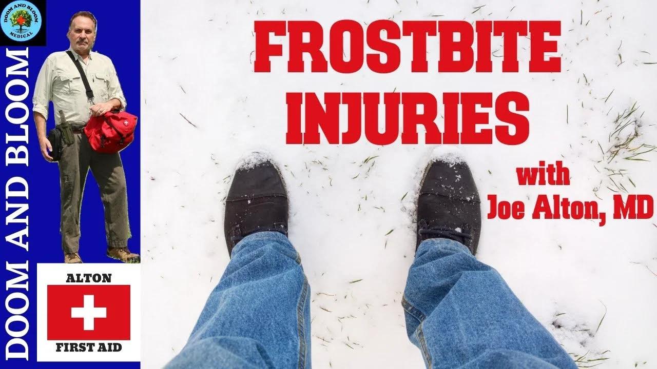 FROSTBITE INJURIES with DR. ALTON