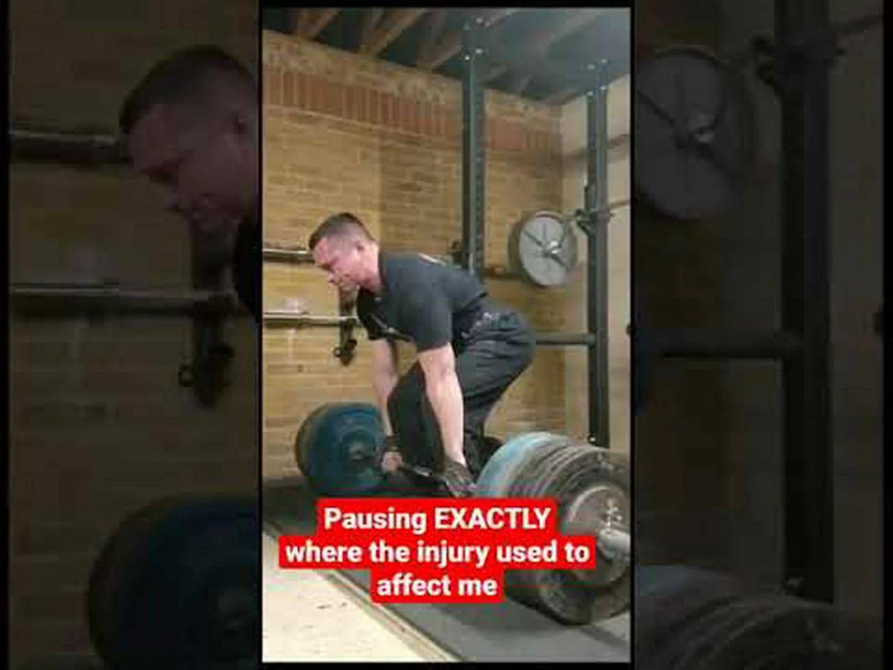 Deadlift injury CURED