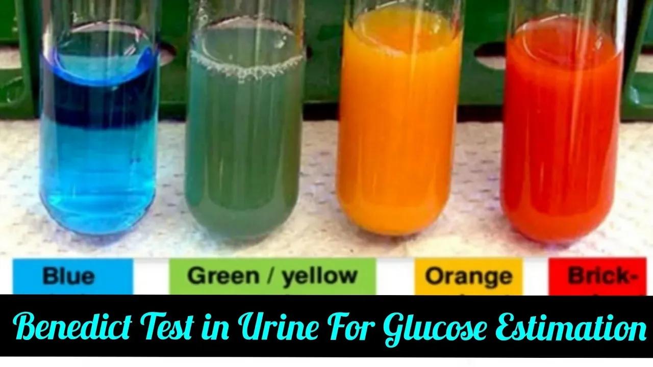 Benedict Test in Urine || Glucose Detection in Urine || Test Procedure ...