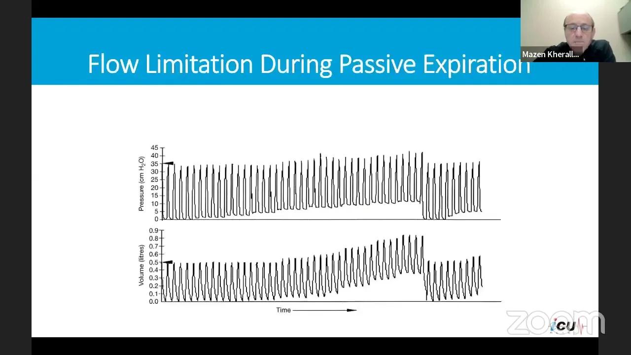 Dynamic Hyperinflation