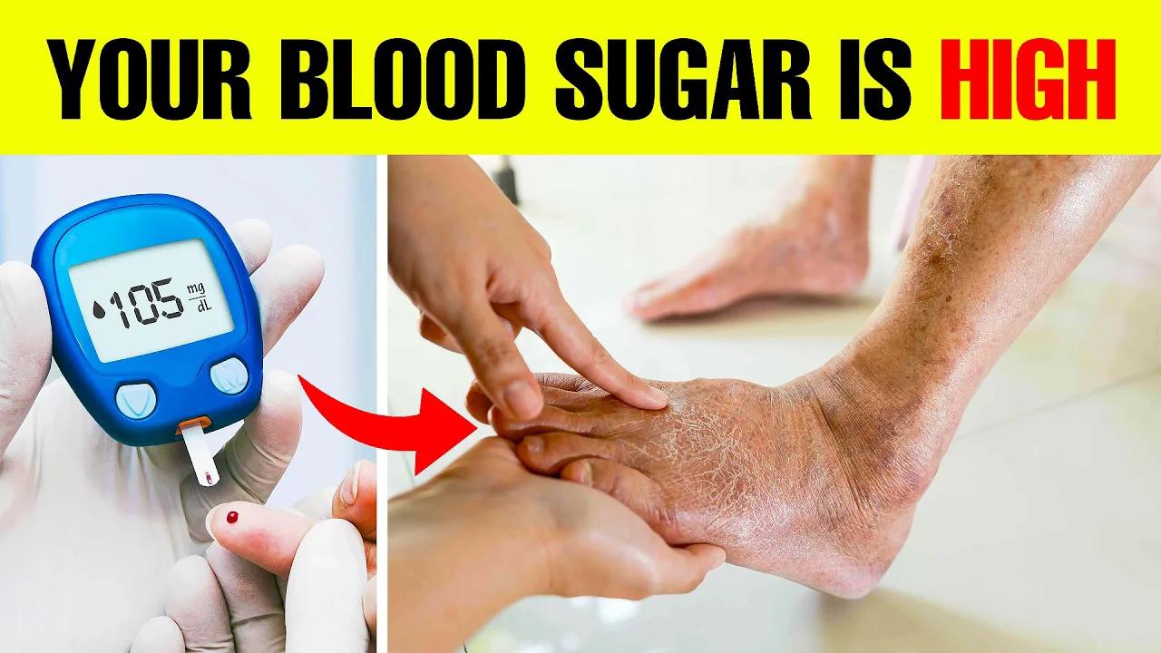 16 Signs Your Blood Sugar Is High & 8 Diabetes Symptoms