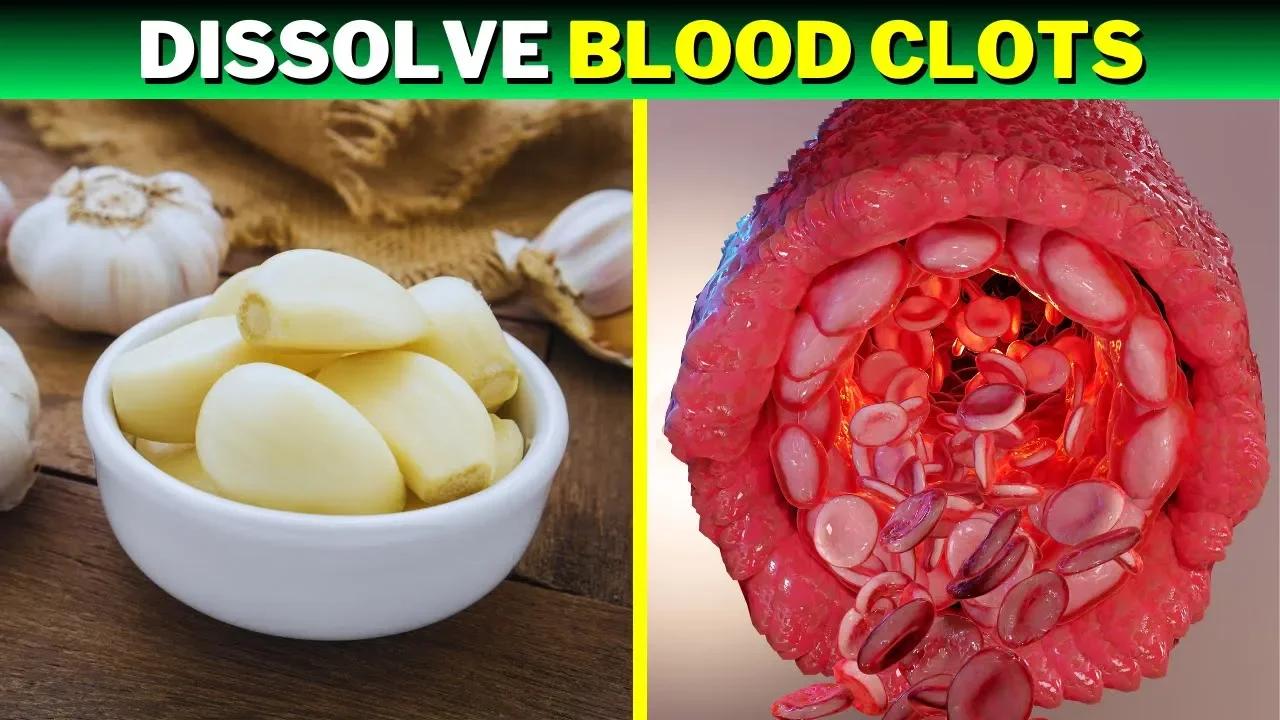 Top 8 Natural Foods MUST-EAT to help Dissolve Blood Clots