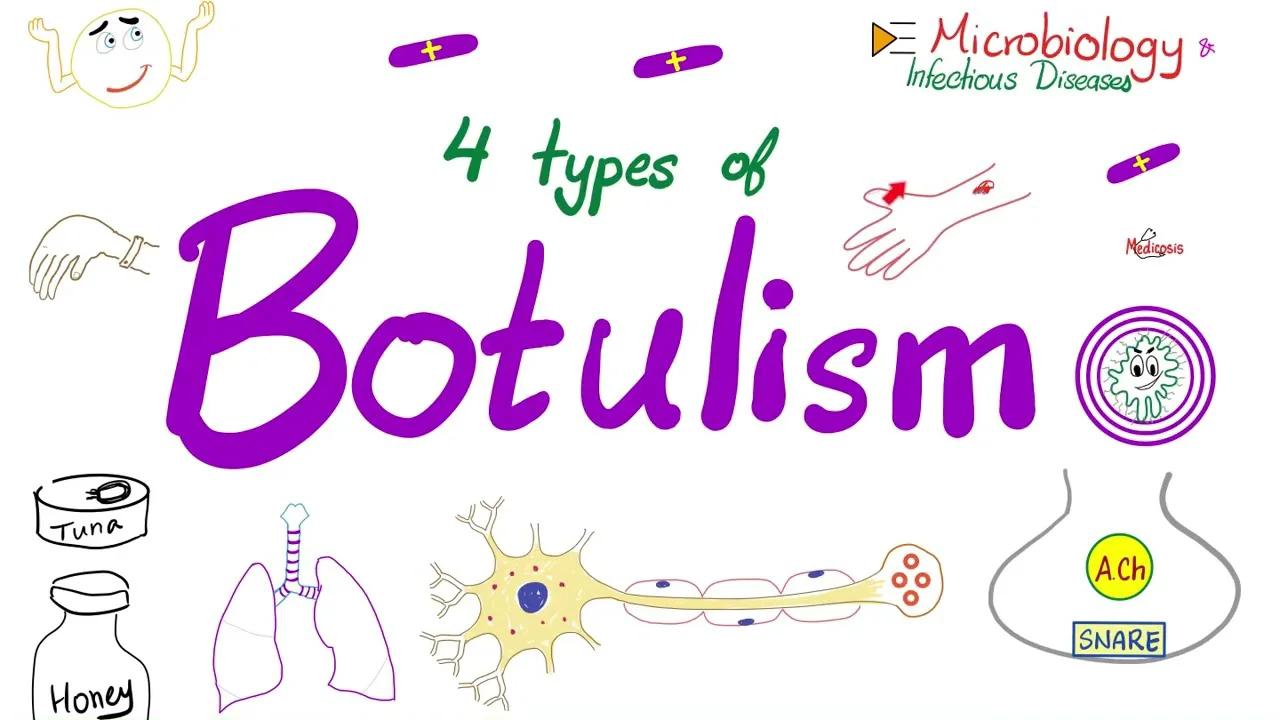 Four Types of Botulism | Food-borne botulism, Infant botulism, Wound ...