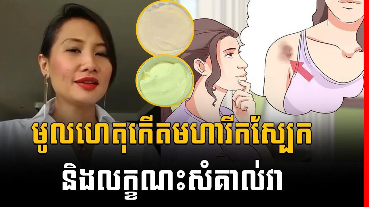 Causes of skin cancer and its symptoms ( In Khmer) មូលហេតុមហារីកស្បែក | Success Reveal