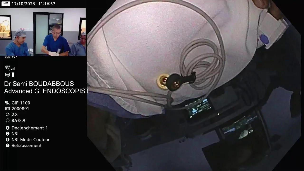 Diagnostic colonoscopy