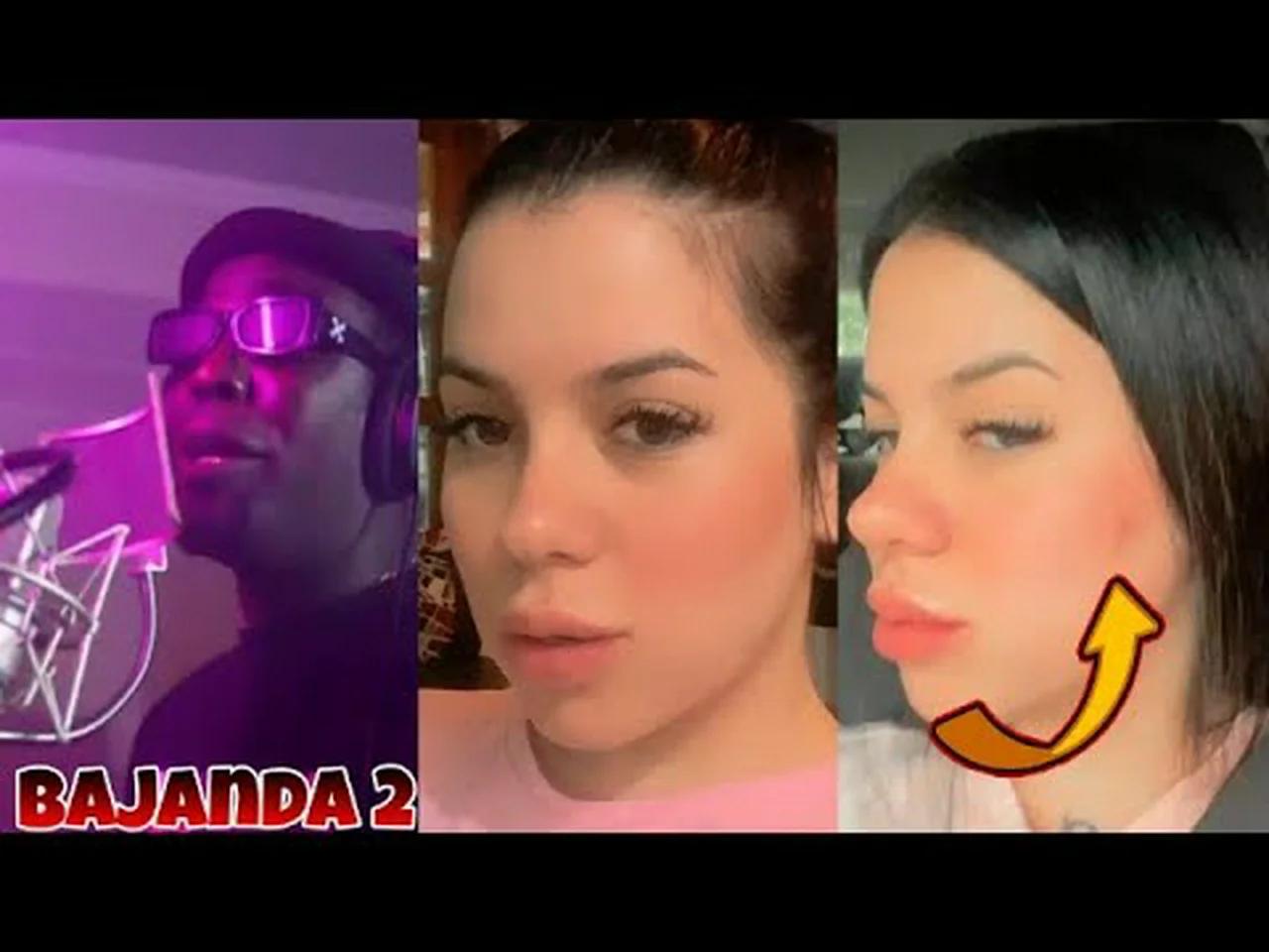 ‼️ Noticia ‼️ La Ex Novia de El Kimiko se opera el rostro/Chocolate va ...