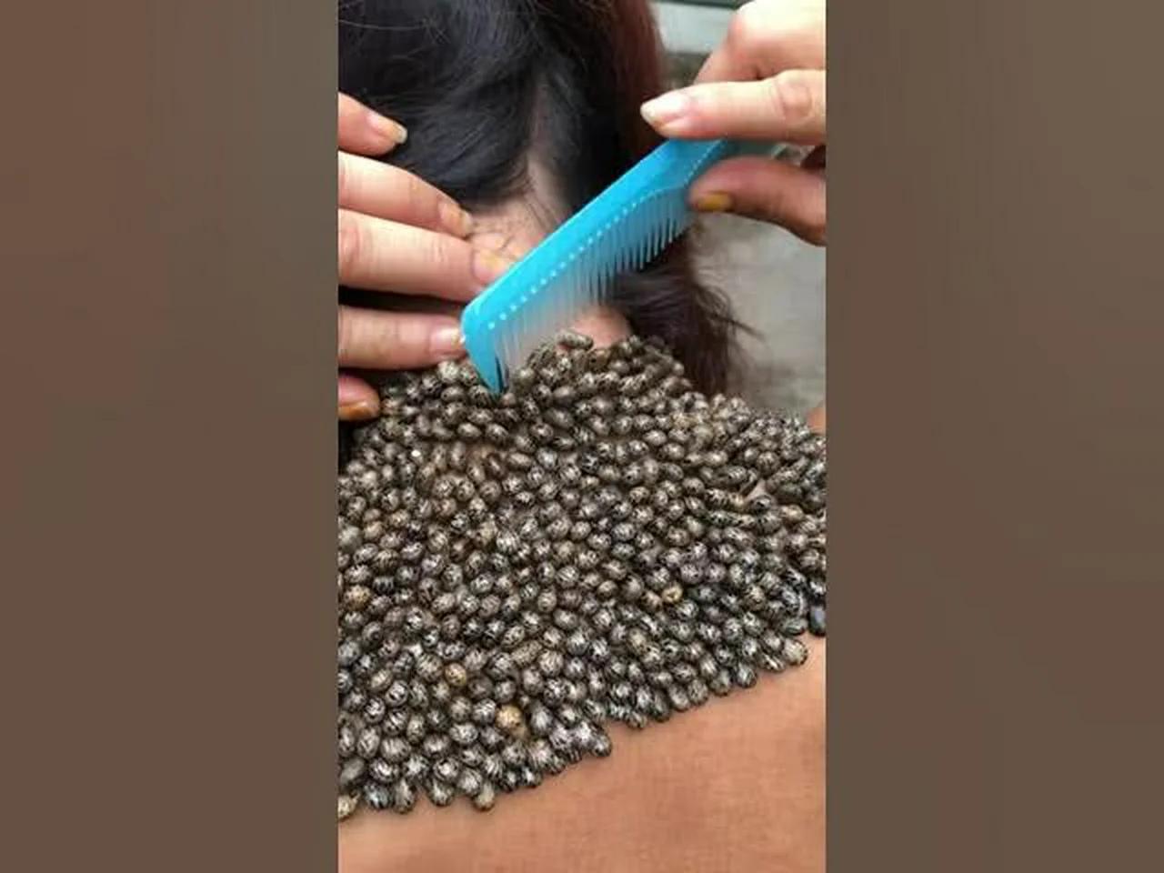 MOST satisfying video|Asmr| so itchy |scalp licer| #asmr #fypシ゚viral # ...
