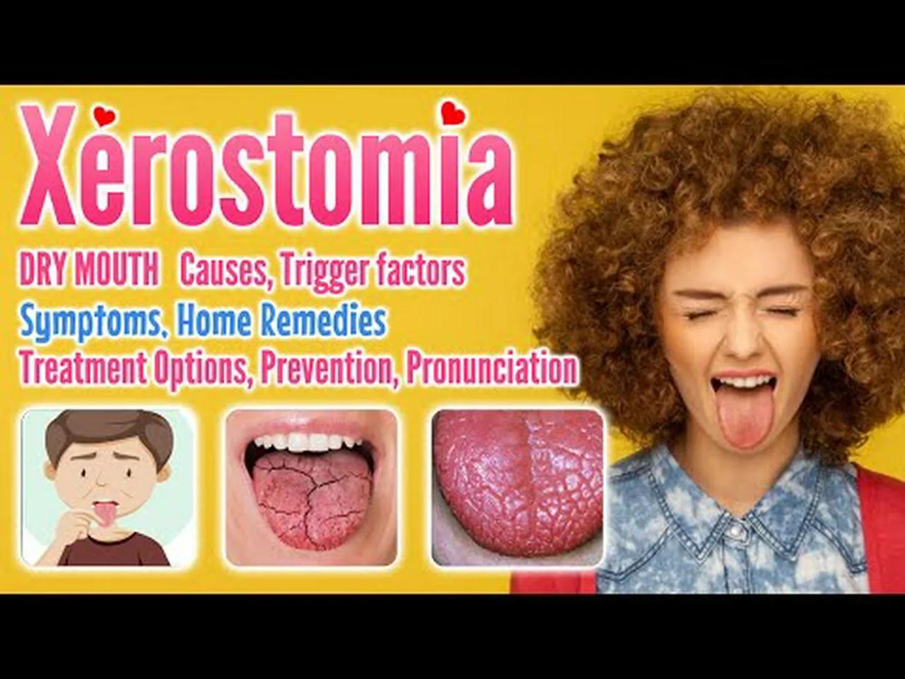 Xerostomia Dry Mouth Causes, Symptoms, Home Remedies, Treatment, Pronunciation, Prevention