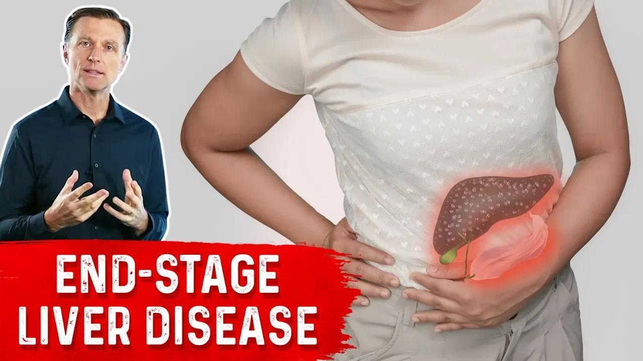 10 Signs of a Dying Liver (End Stage Liver Disease)