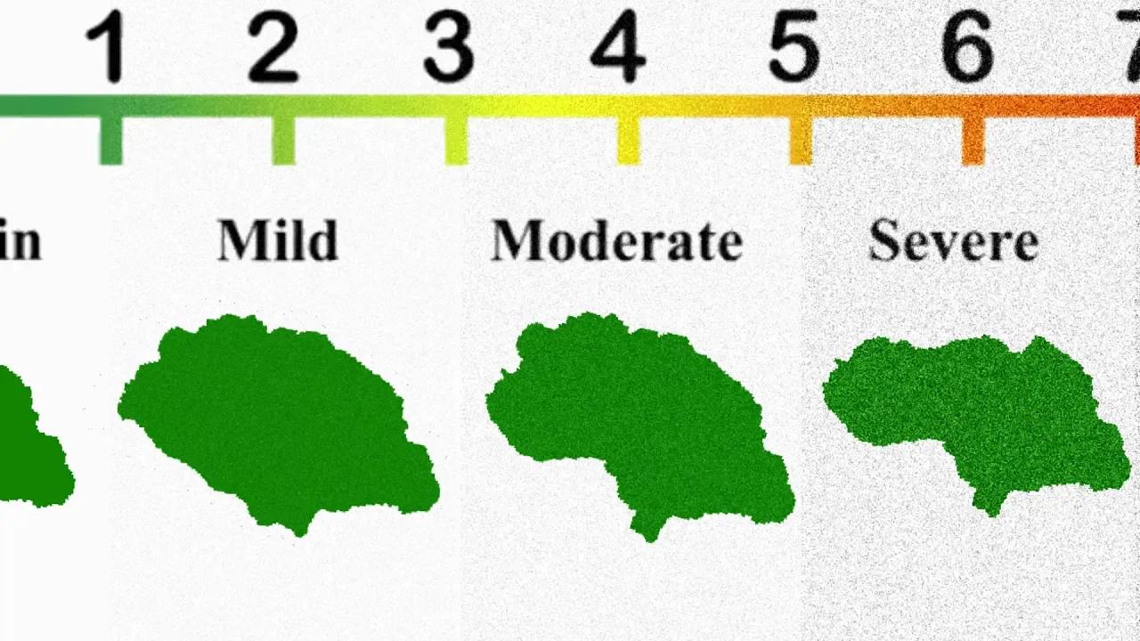pain scale meme - Hungary